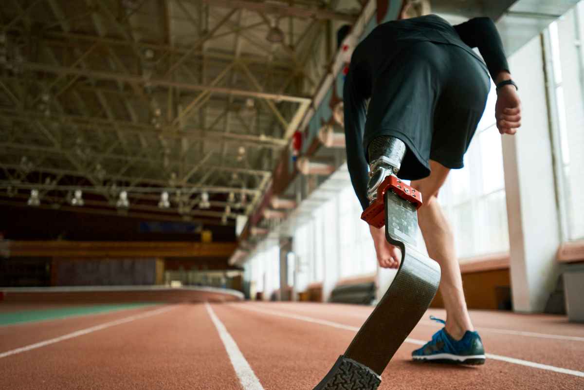 Amputations and Prosthetics: How Physical Therapists Help Amputees ...