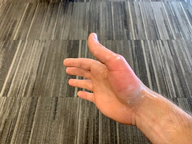 IASTM: Here’s How it Works to Decrease Pain and Improve Mobility ...