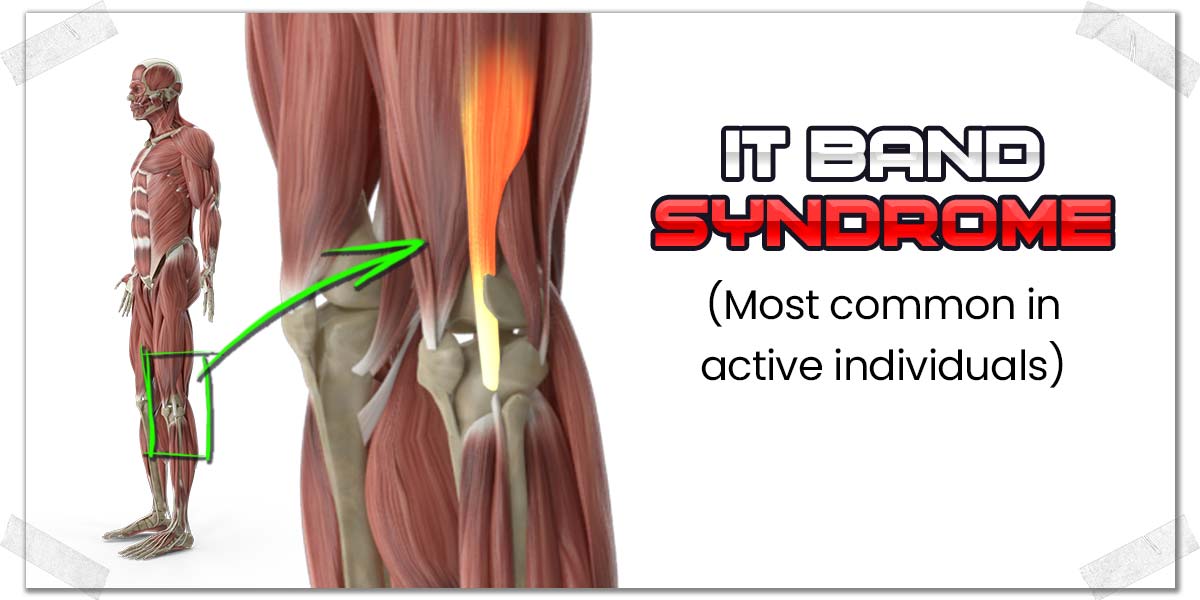 Knee Pain With Leg Curls | Common Causes & Solutions (Expert Tips ...