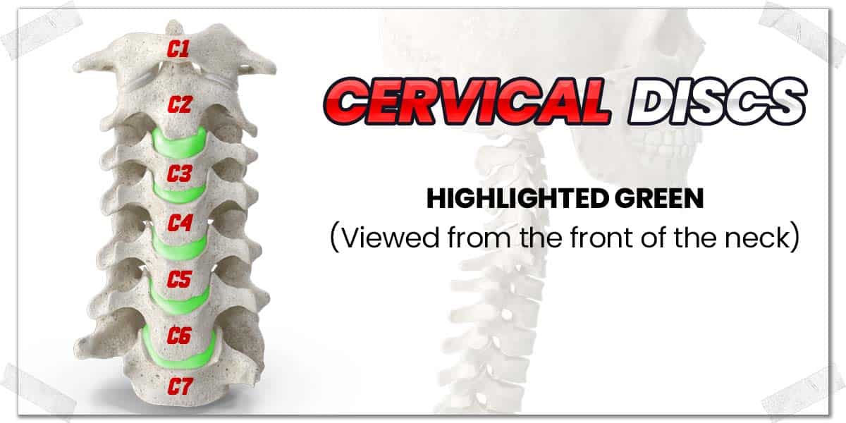 How to Fix Neck Pain from Squats (And Why It Happens) | Expert Insight ...