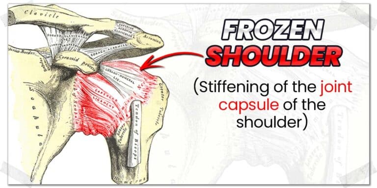 5 Reasons Why One Shoulder Is Tighter Than The Other (& Solutions ...