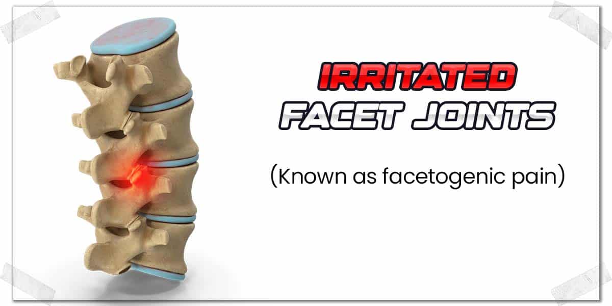 Lifter's Guide: Low Back Pain From Squatting | What To Know & Do ...